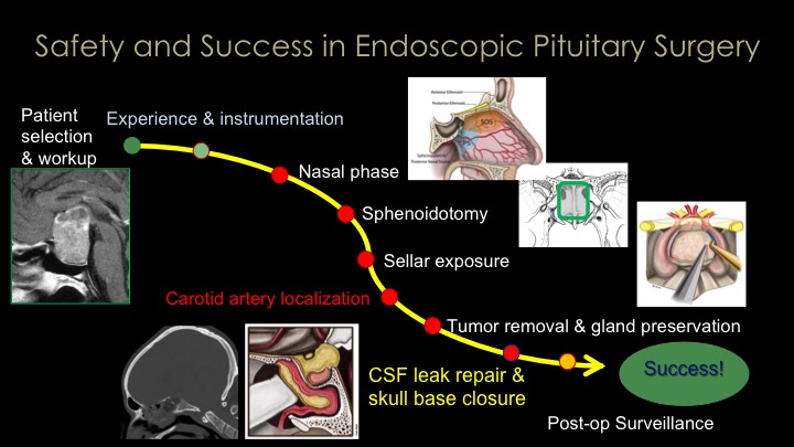 Keeping Cerebrospinal Fluid Leaks and Meningitis at Bay | Pacific ...