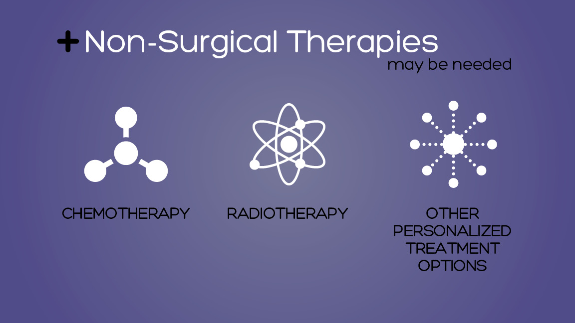Keyhole Surgery for Brain Tumor Removal | Pacific Neuroscience Institute