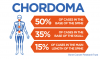 Chordoma: Symptoms, Treatment & Diagnosis | Pacific Brain Tumor Center