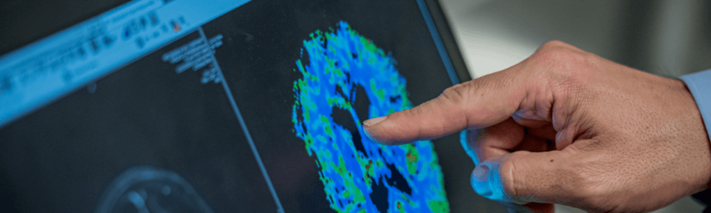 Ventricular Reservoir Placement | Pacific Adult Hydrocephalus Center