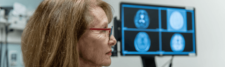 Symptoms & Treatment of Normal Pressure Hydrocephalus | Pacific Adult ...