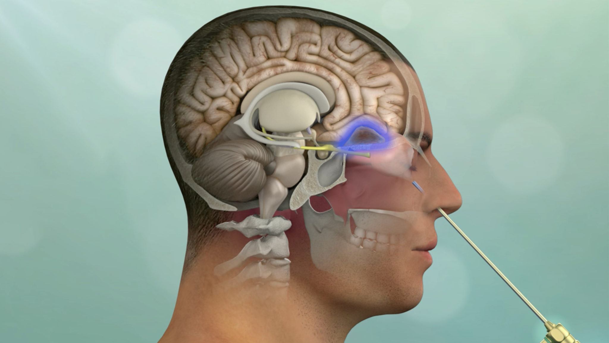 Endoscopic Endonasal Procedures | Pacific Pituitary Disorders Center