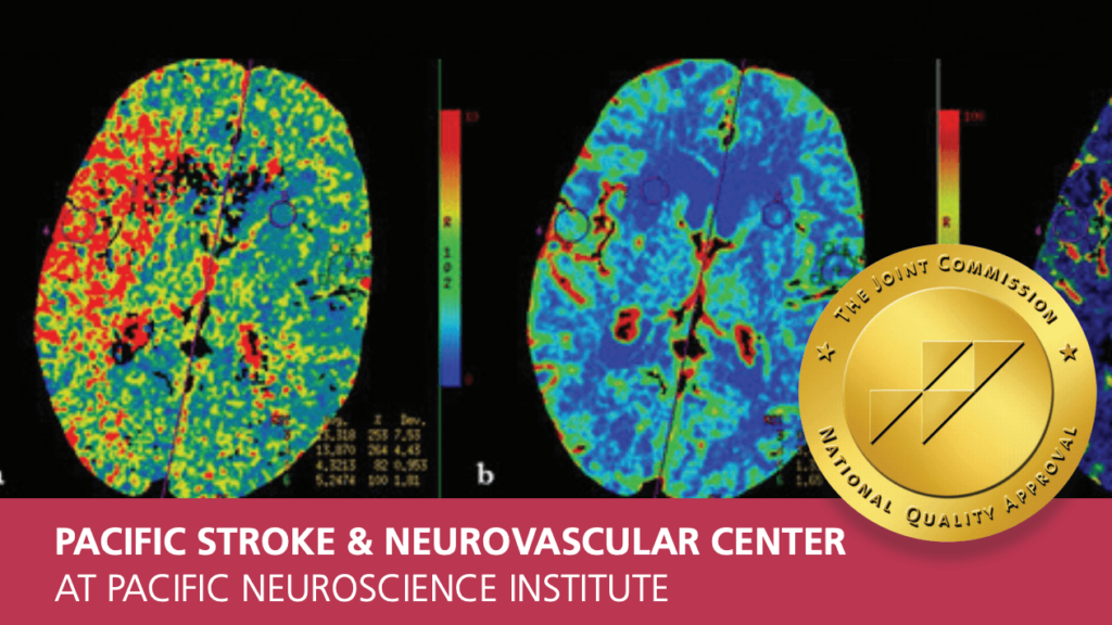 Pacific Stroke And Neurovascular Center Santa Monica Los Angeles Ca