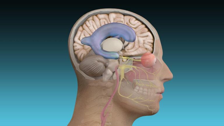 Understanding Normal Pressure HydrocephalusTreatment Options | Pacific ...