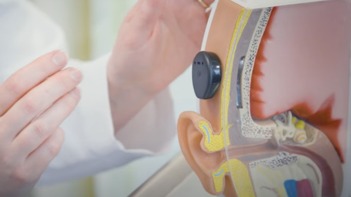 The Link Between Hearing Loss and Cognitive Decline | PNI