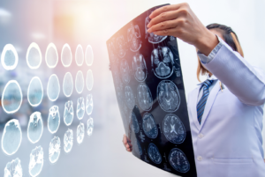 What Can I Expect With Deep Brain Stimulation (DBS) Surgery?