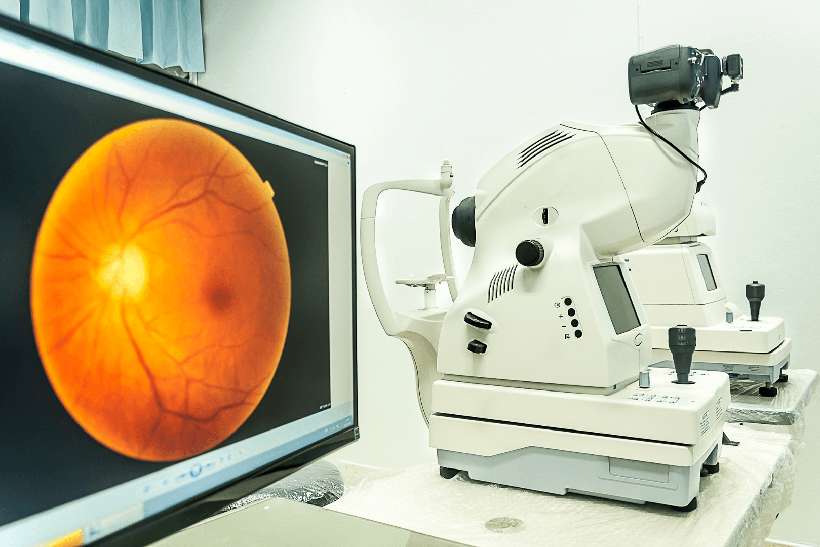 AI Analysis of Retinal Photography for Predicting Health Issues